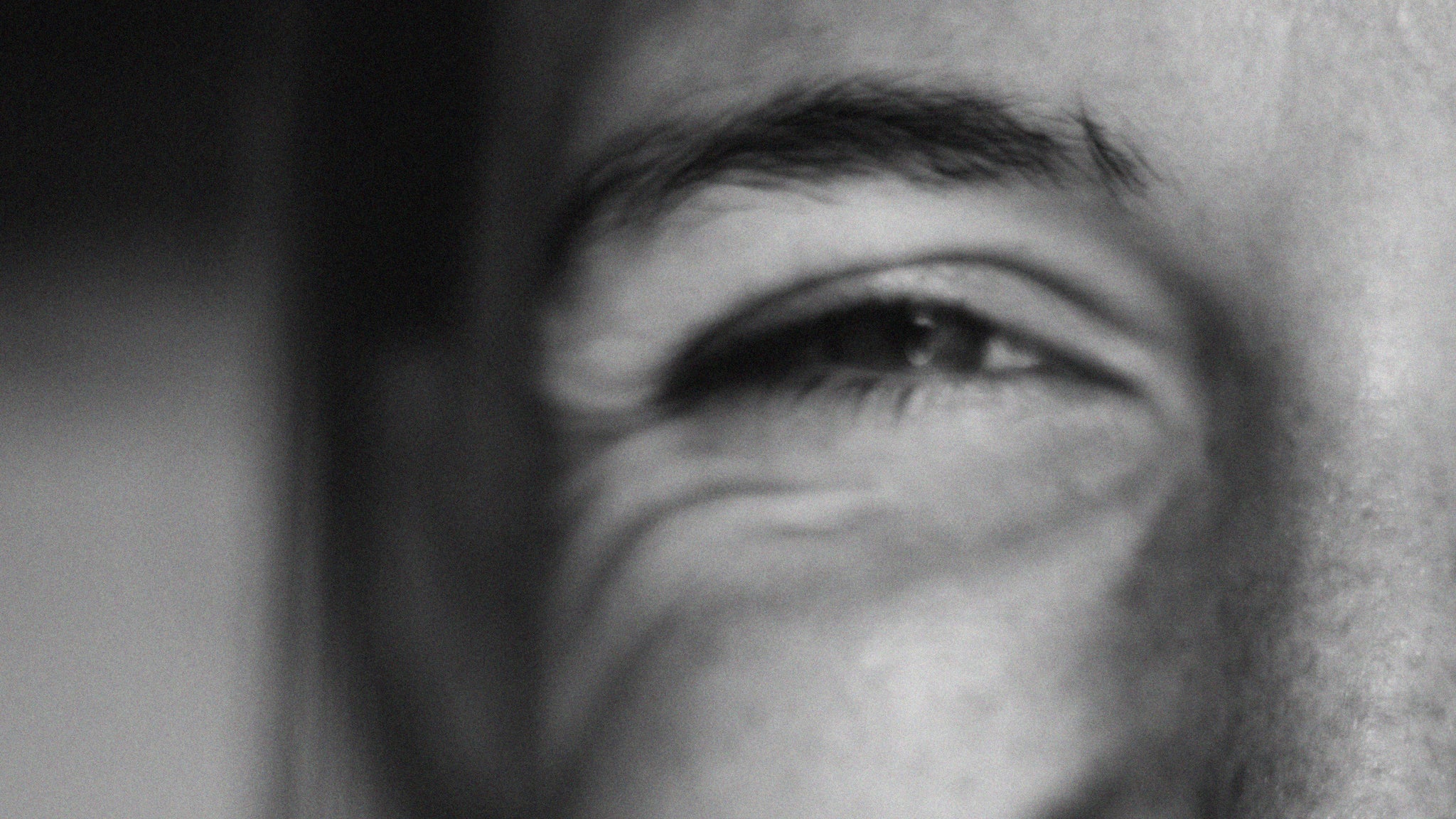 How To Treat Under-Eye Wrinkles & Crows Feet – Dr Sam's